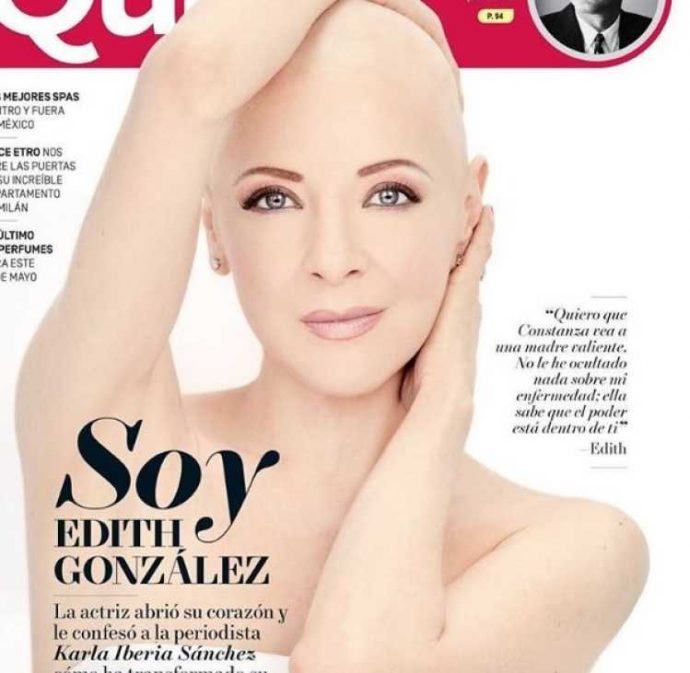 Edith González muestra su cabeza rapada en medio de su lucha contra el ...