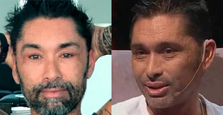 Chino Ríos reveló detalles de su comentada cirugía facial - Tecache.cl