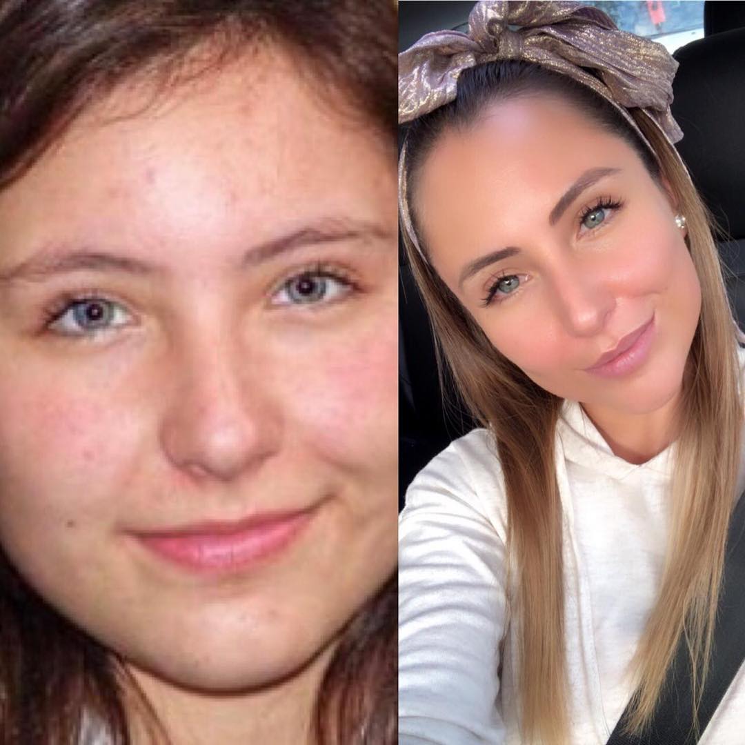 Ángela Duarte se une al 'Puberty Challenge' y sorprende con su antes y ...