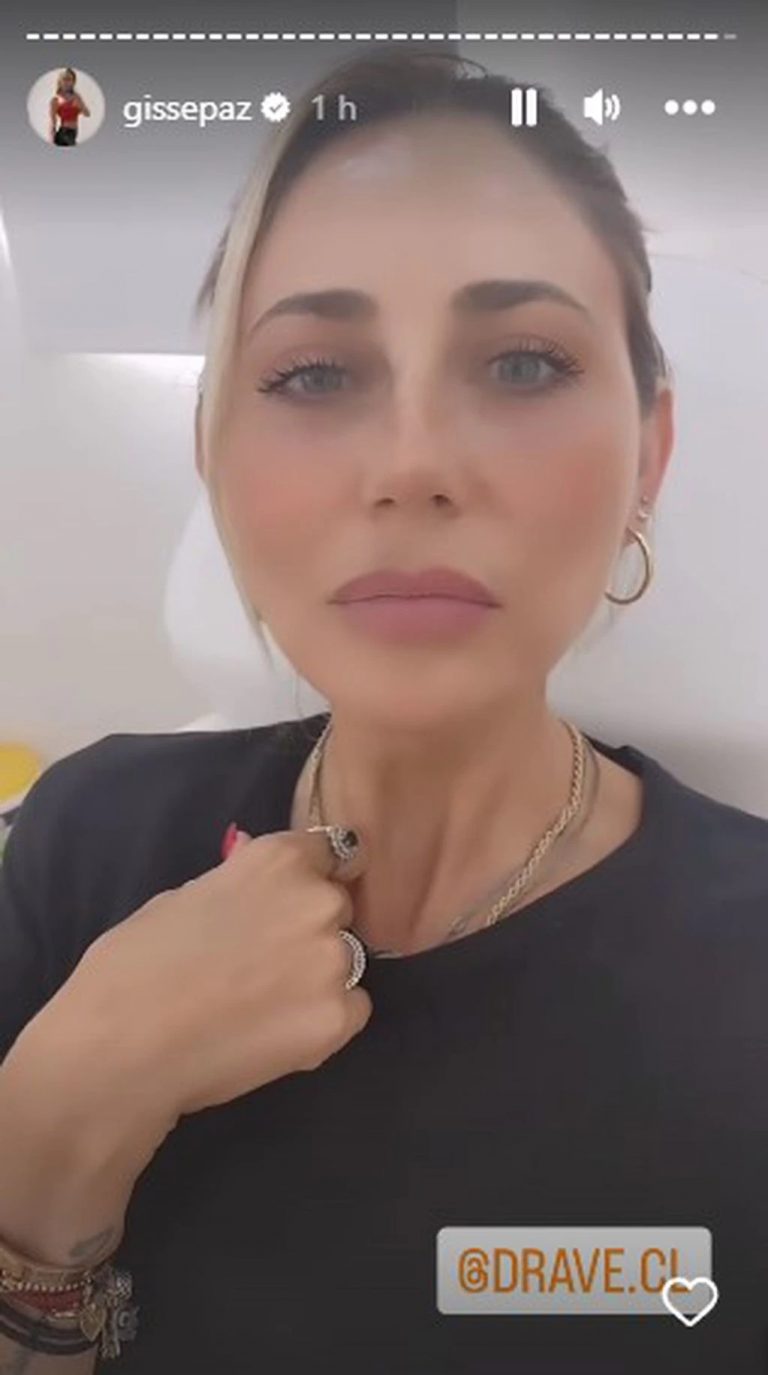 "Me saqué toda la boca...": Gissella Gallardo se sometió a ...