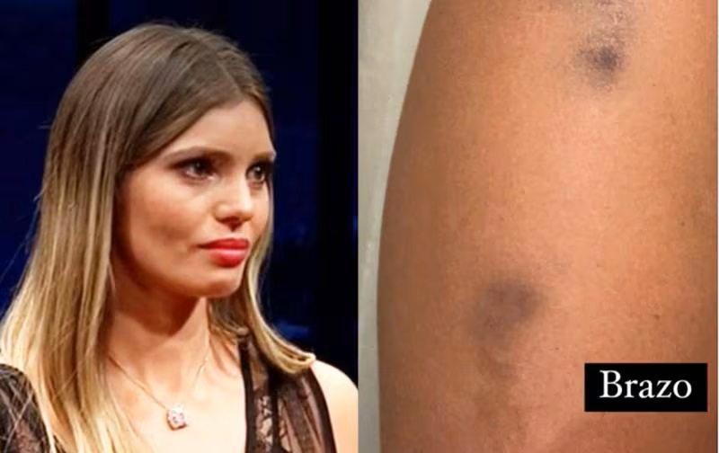 ¿Volverá la TV? Hugo Valencia cuenta cómo está Faloon Larraguibel tras ...