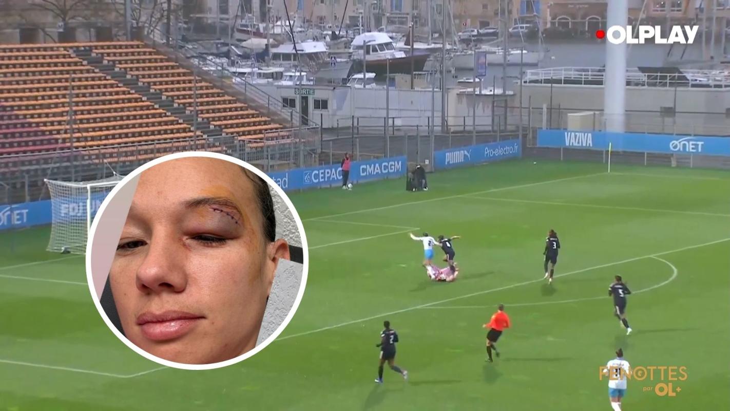 Endler sufre fuerte golpe en goleada del Olympique Lyon: así reaccionó ...