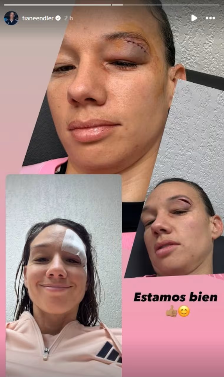 Endler sufre fuerte golpe en goleada del Olympique Lyon: así reaccionó ...